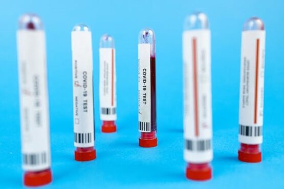 14 Essential Types of Vacutainers: How to Choose the Right One