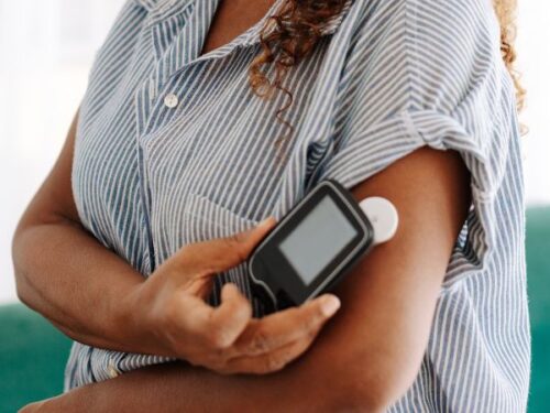 Dexcom G7 Phone Compatibility: Which Devices Make the Cut