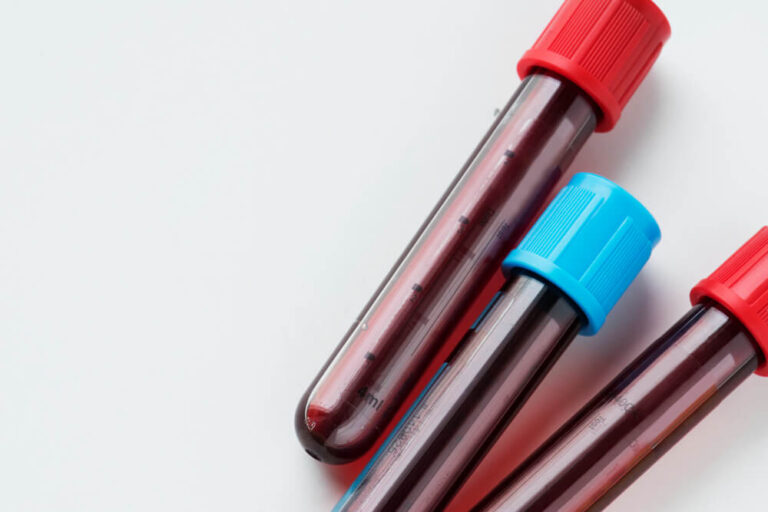 What Is a Blood Test Tube? Types, Colors & Their Meaning - Health ...